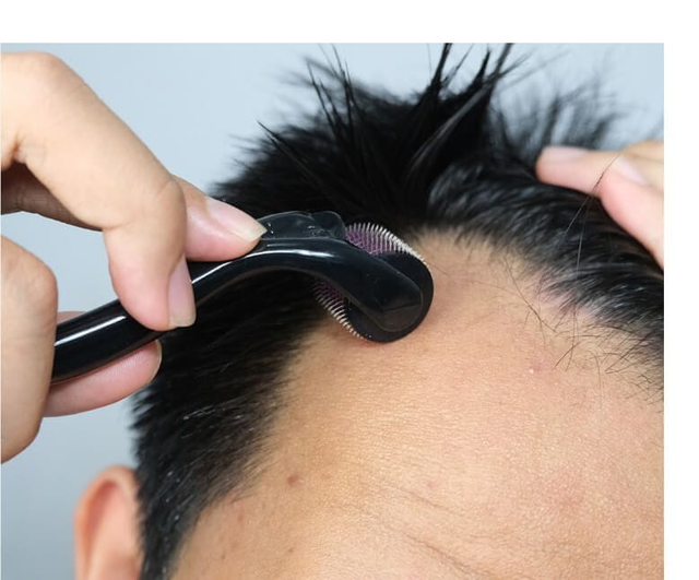 Folitin Hair Growth Serum For Hair Regrowth & Scalp Health