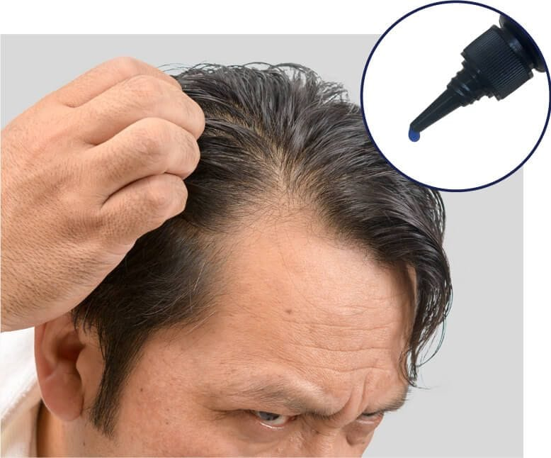 Folitin Hair Growth Serum For Hair Regrowth & Scalp Health